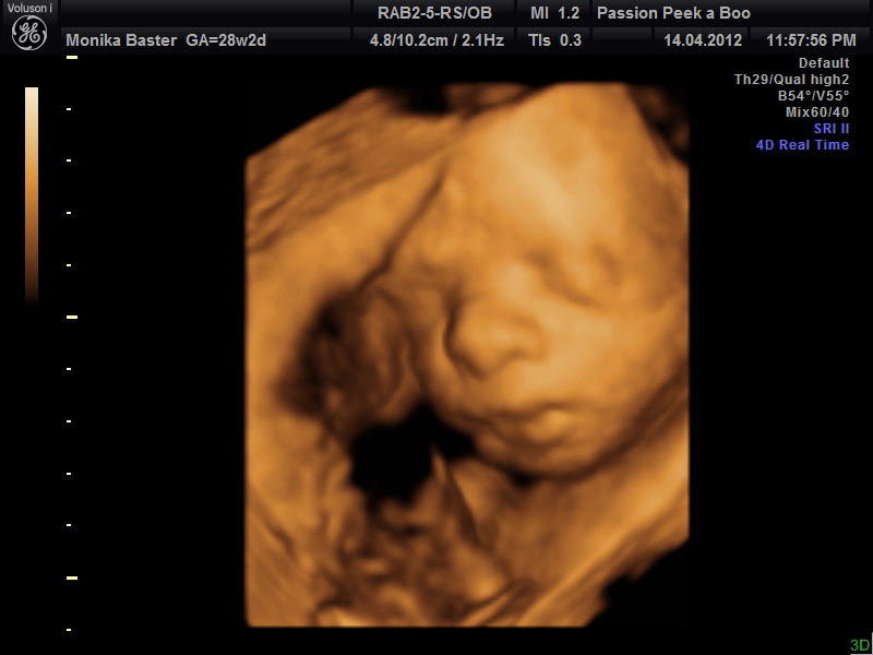 MY BABY’S 3D SCAN – monikabaster.com