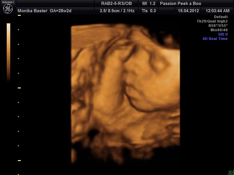 MY BABY’S 3D SCAN – monikabaster.com