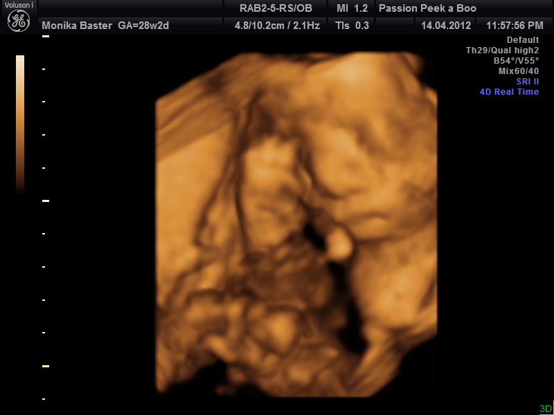 MY BABY’S 3D SCAN – monikabaster.com